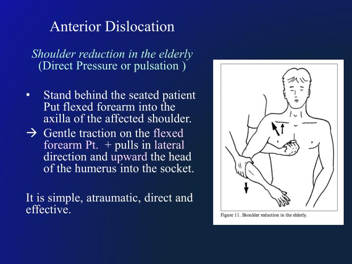 PPT - Shoulder Dislocation PowerPoint Presentation - ID:4841498