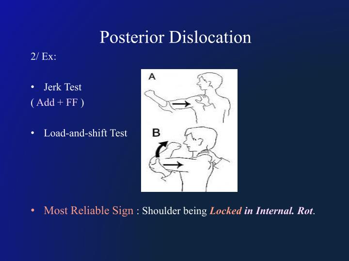 PPT - Shoulder Dislocation PowerPoint Presentation - ID:4841498