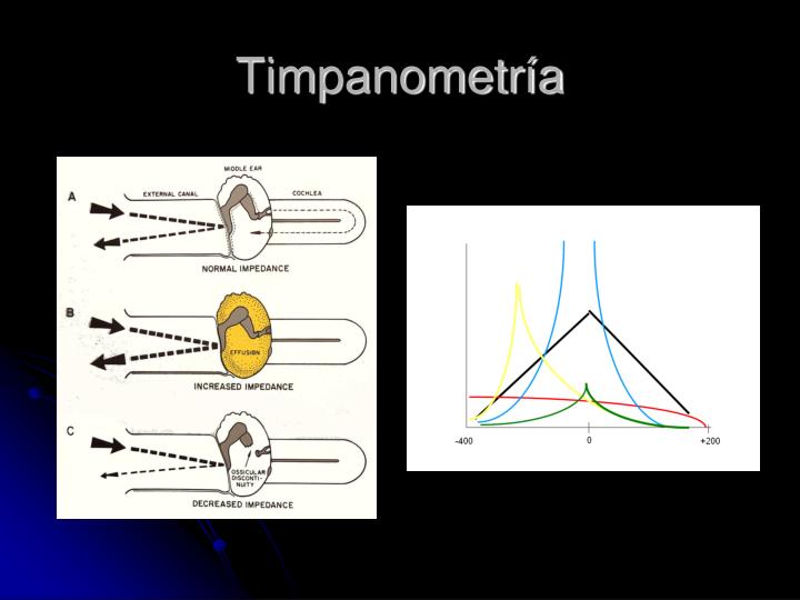 PPT - Hipoacusia y Audiometrias PowerPoint Presentation - ID:4841601
