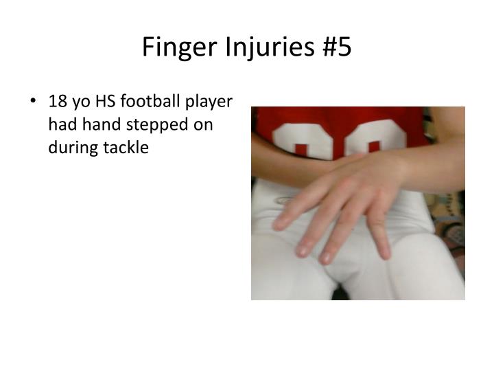 PPT - Sports-Related Hand and Wrist Injuries PowerPoint Presentation ...