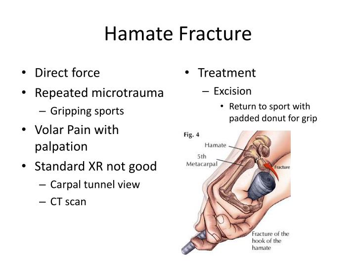 PPT - Sports-Related Hand and Wrist Injuries PowerPoint Presentation ...