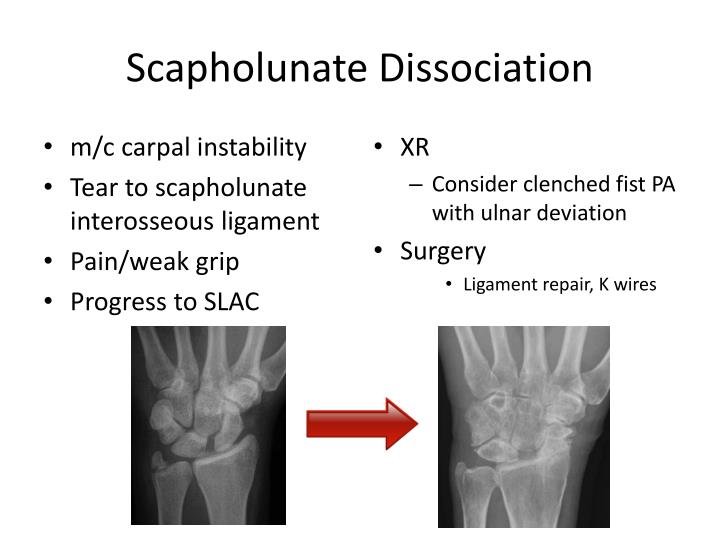 PPT - Sports-Related Hand and Wrist Injuries PowerPoint Presentation ...