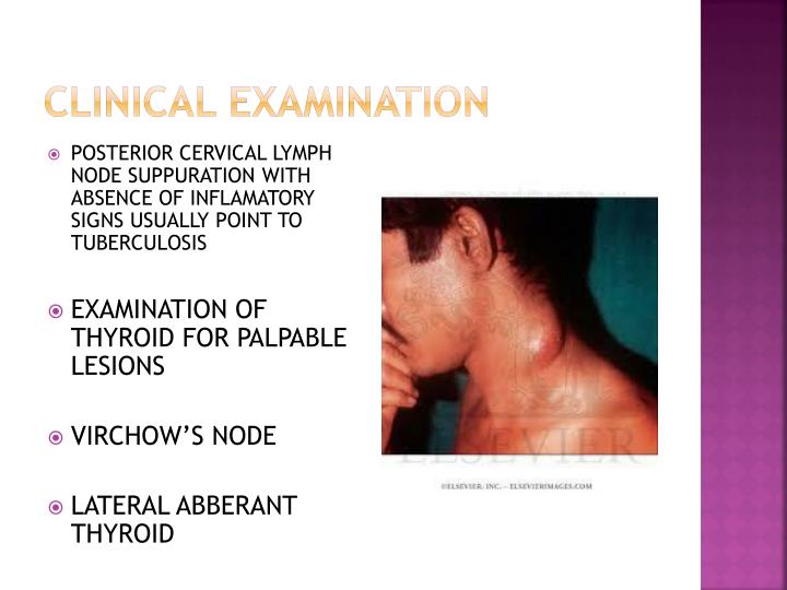 PPT - CERVICAL LYMPHADENOPATHY PowerPoint Presentation - ID:4847833
