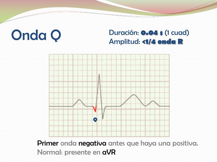 PPT - INTERPRETACION BÁSICA DE ELECTROCARDIOGRAMA PowerPoint ...