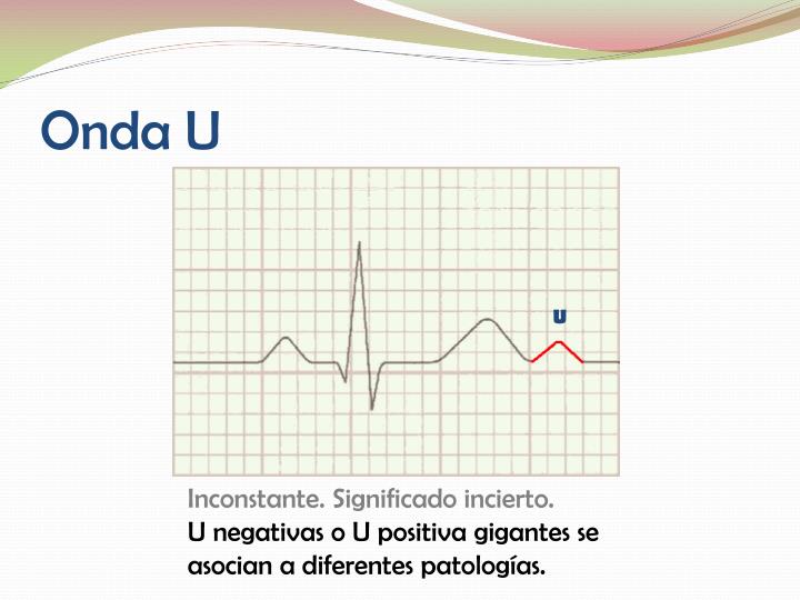 PPT - INTERPRETACION BÁSICA DE ELECTROCARDIOGRAMA PowerPoint ...