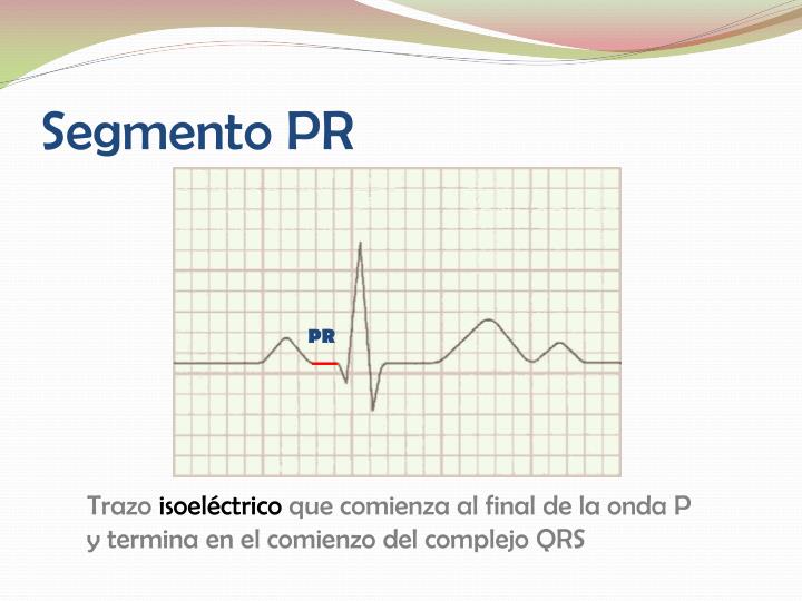 PPT - INTERPRETACION BÁSICA DE ELECTROCARDIOGRAMA PowerPoint ...