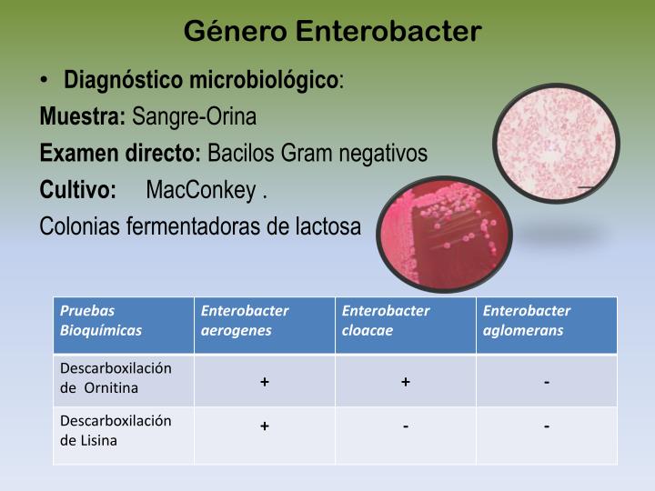 PPT - TEMA #15: ENTEROBACTERIAS III PowerPoint Presentation - ID:4851946
