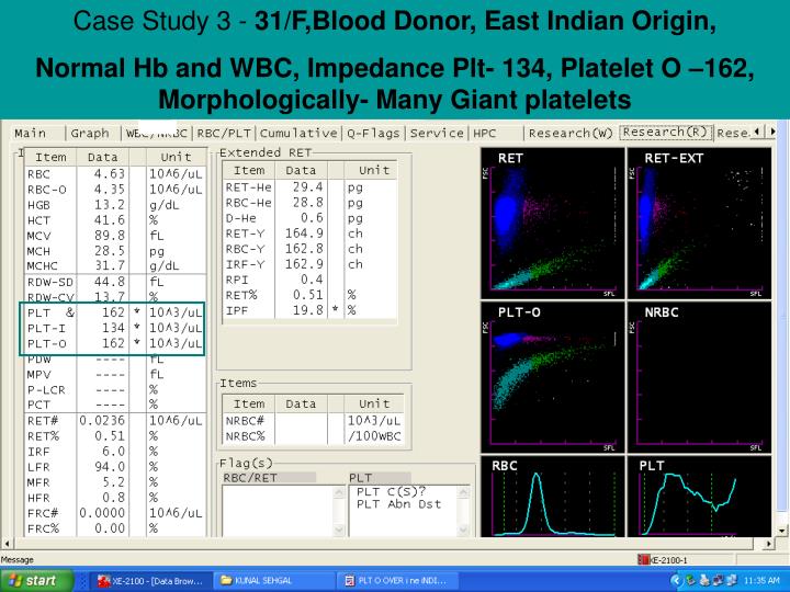 PPT - Platelet Counts PowerPoint Presentation - ID:4855218