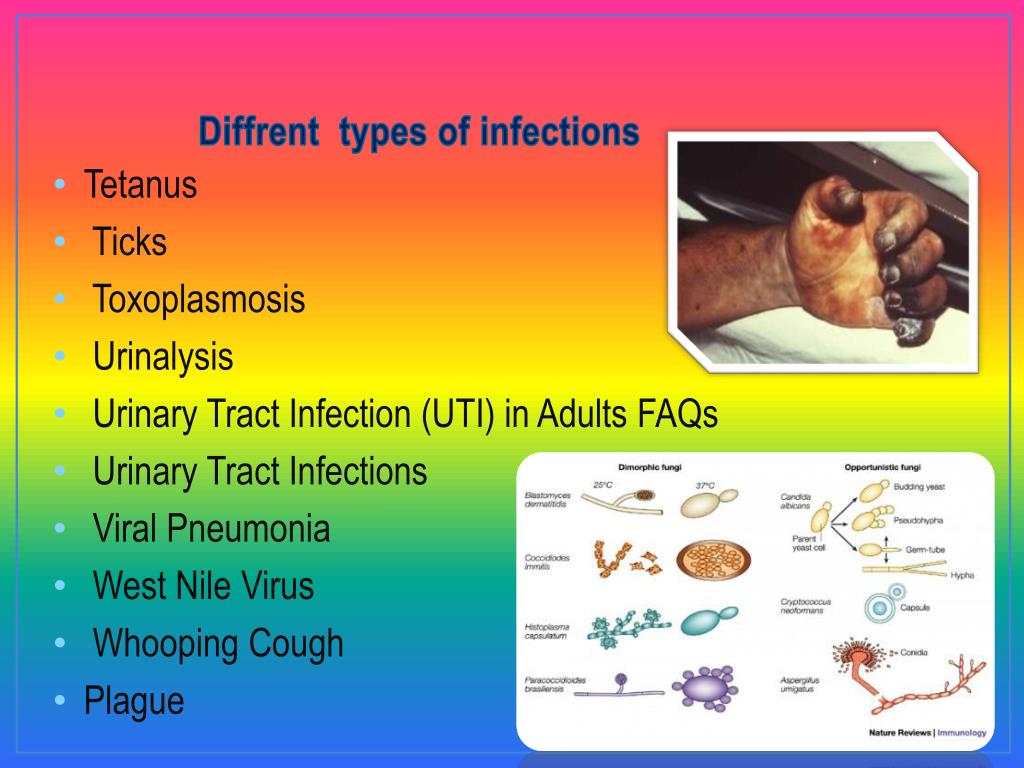 PPT - Medical Emergency Infections With Casey Hughes By: Bianca ...