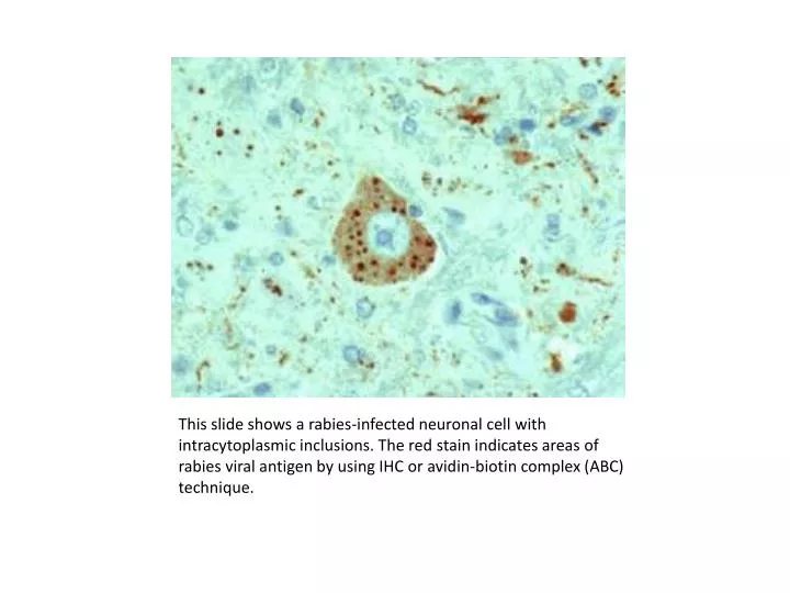 PPT - Immunostaining PowerPoint Presentation, free download - ID:4871333