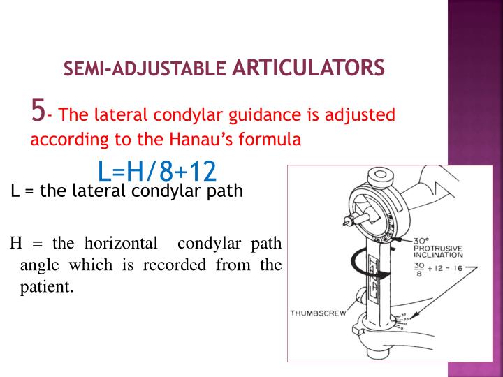 PPT - Class III Semi-adjustable condylar path articulators PowerPoint ...