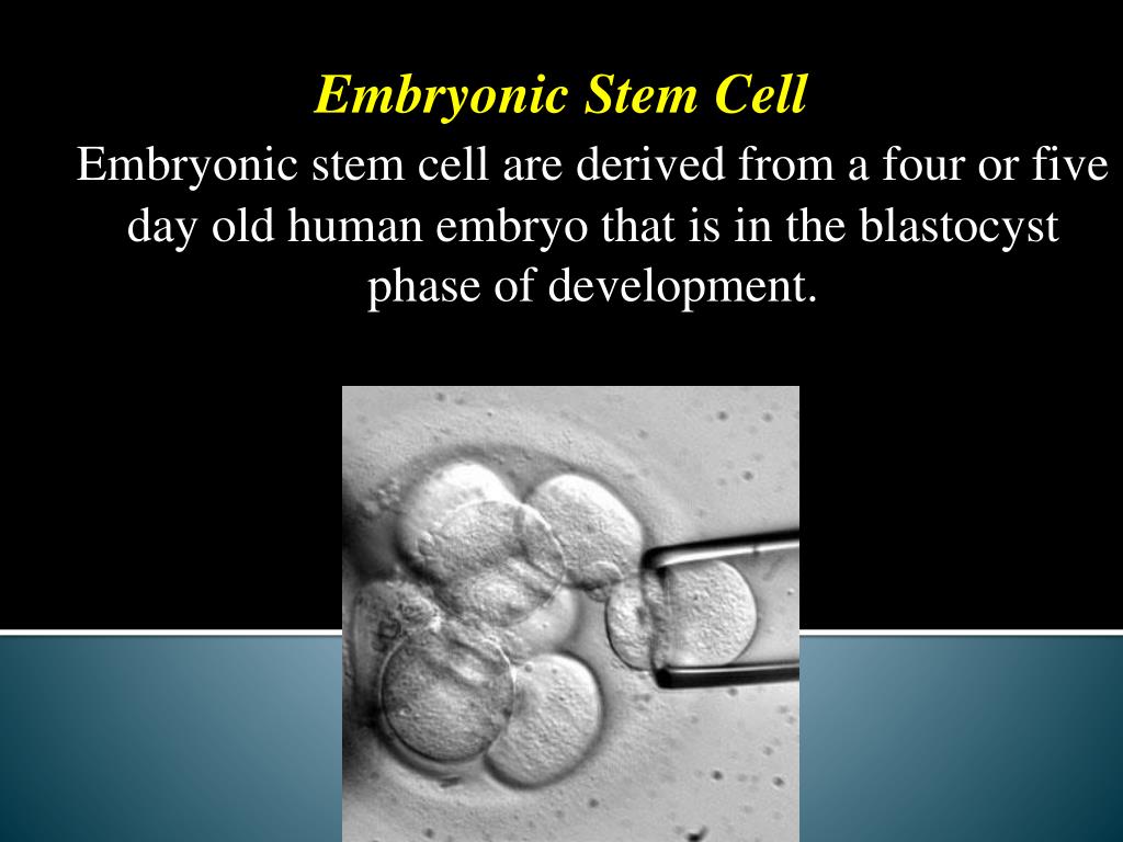 PPT Stem Cell PowerPoint Presentation Free Download ID 4875198 PPT Stem Cell PowerPoint Presentation Free Download ID 4875198