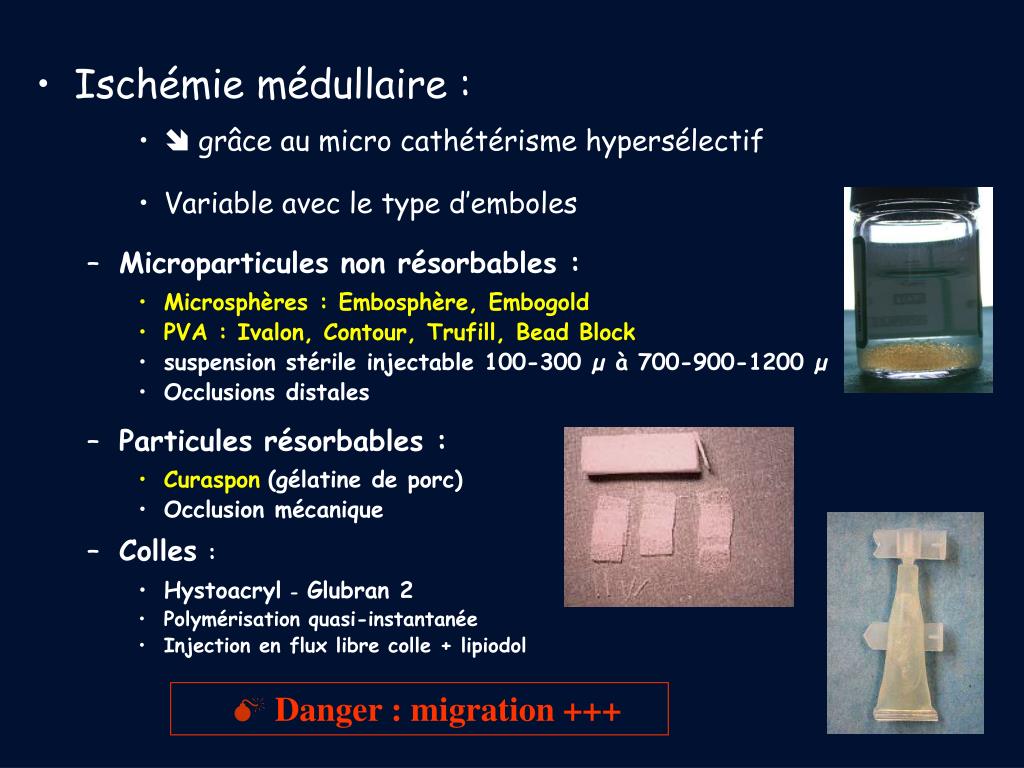 PPT - Hémoptysies menaçantes place de la radiologie interventionnelle ...