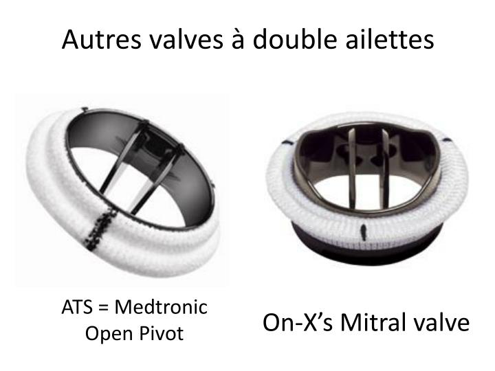 PPT - "Histoire de Valves" PowerPoint Presentation - ID:4880346