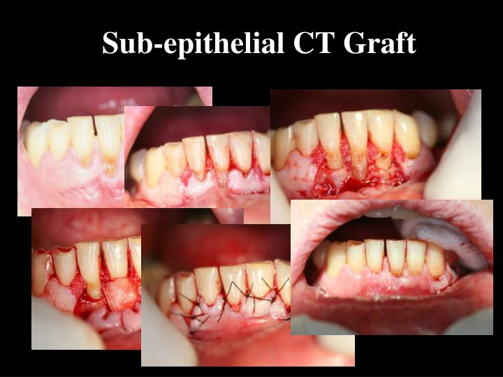 PPT - Periodontal Aesthetics PowerPoint Presentation - ID:4890149