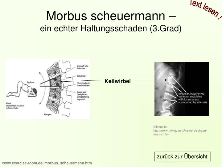 PPT - Haltung (Haltungsfehler) PowerPoint Presentation - ID:4890460