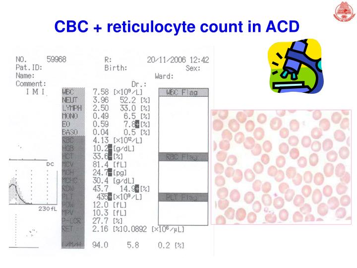 PPT - Peripheral blood smear examination PowerPoint Presentation - ID ...