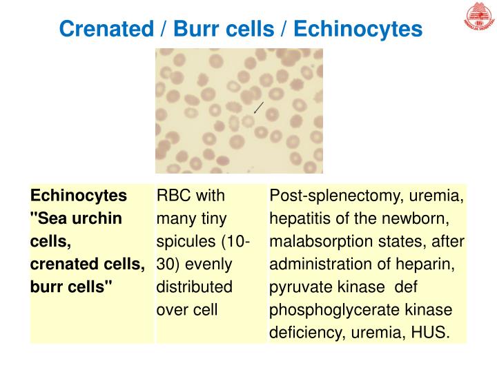 PPT - Peripheral blood smear examination PowerPoint Presentation - ID ...