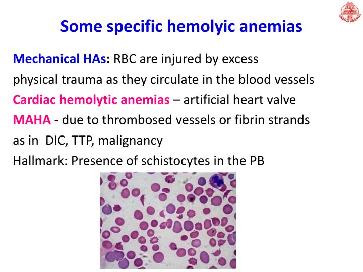 PPT - Peripheral blood smear examination PowerPoint Presentation - ID ...