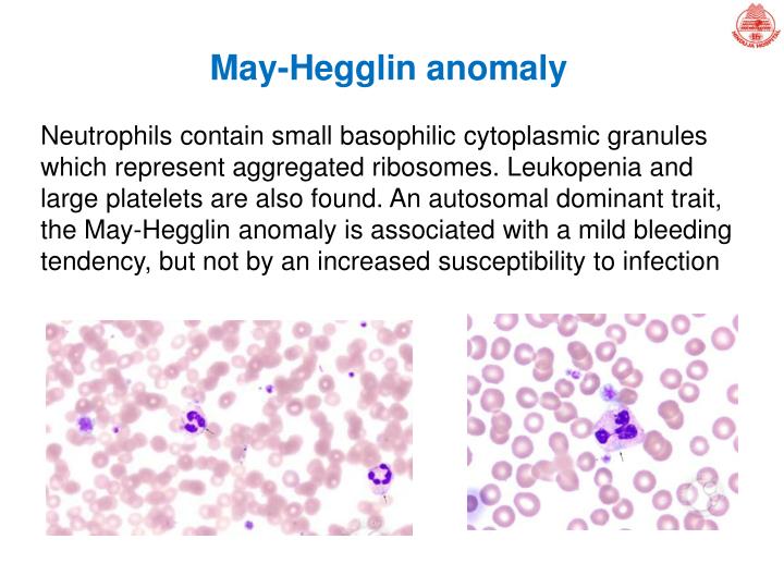 PPT - Peripheral blood smear examination PowerPoint Presentation - ID ...