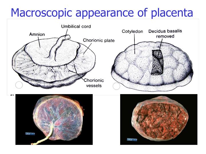 PPT - Fetal membranes, umbilical cord and placenta PowerPoint ...