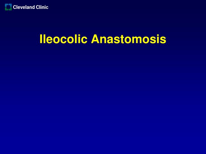 PPT - Tips and Tricks of Avoiding and Management of Anastomotic ...