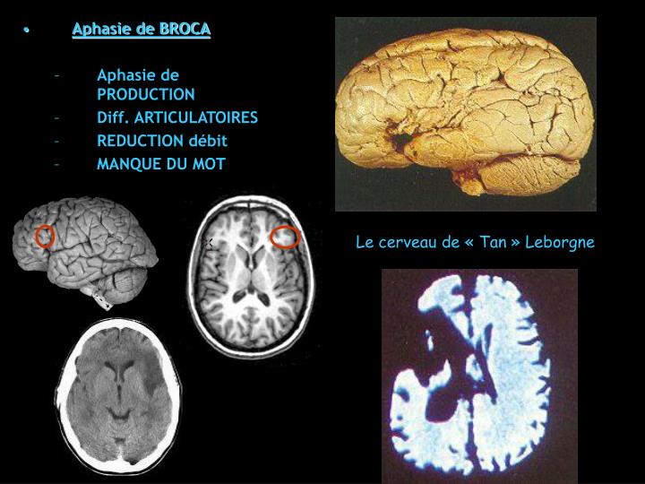PPT - CERVEAU & PLASTICITE CEREBRALE PowerPoint Presentation - ID:4900917