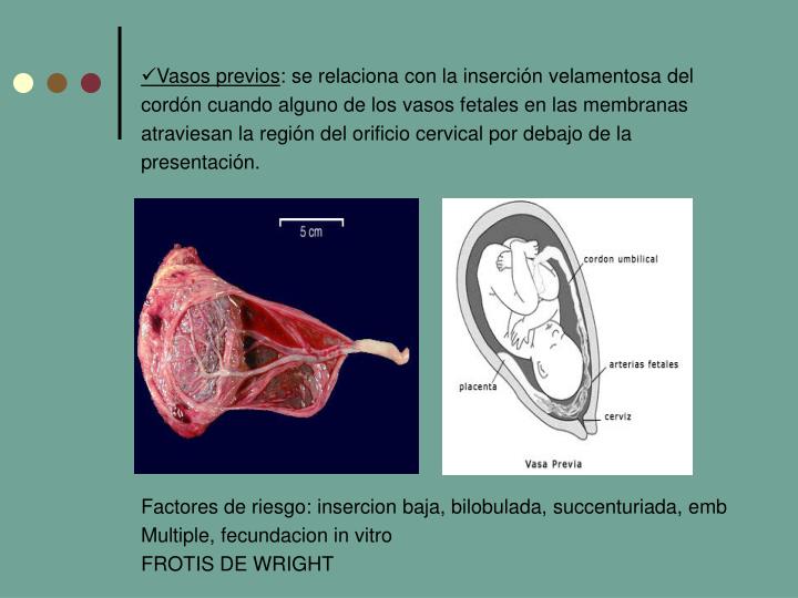PPT - ANOMALIAS DE LA PLACENTA, CORDON UMBILICAL Y MEMBRANAS PowerPoint ...