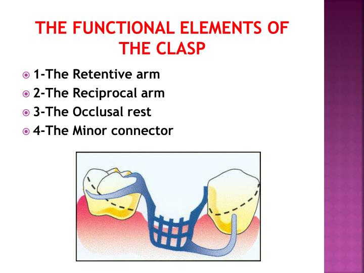 PPT - Planning the design for removable partial dentures PowerPoint ...