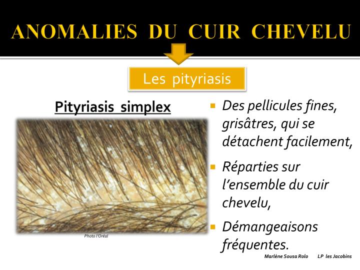 PPT - ANOMALIES DU CUIR CHEVELU PowerPoint Presentation - ID:4905276