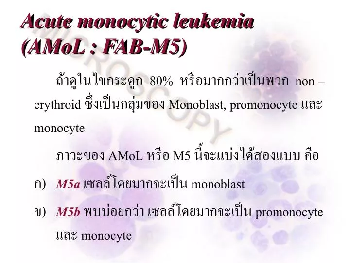 PPT - Acute monocytic leukemia (AMoL : FAB-M5) PowerPoint Presentation ...