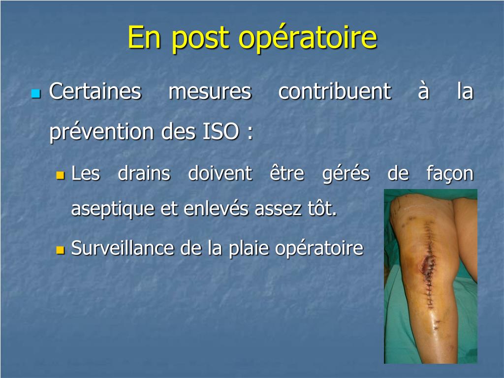 PPT - PREVENTION DE L’INFECTION PERIOPERATOIRE EN CHIRURGIE ...