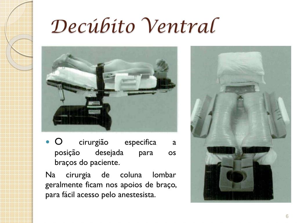 PPT Posicionamento Cir rgico Em Neurocirurgia PowerPoint Presentation