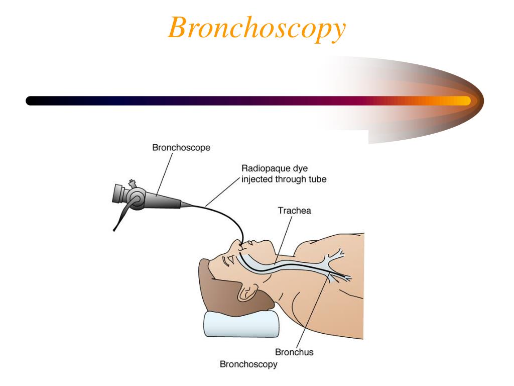 PPT - Nursing of Adults With Medical & Surgical Conditions PowerPoint ...