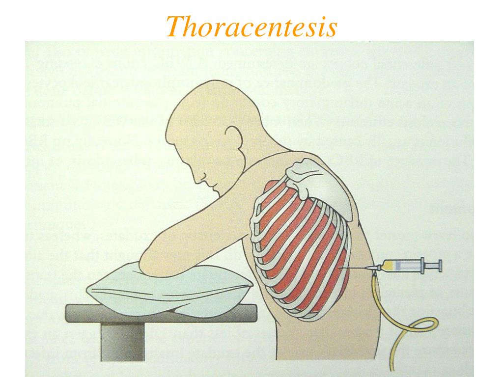 PPT - Nursing of Adults With Medical & Surgical Conditions PowerPoint ...