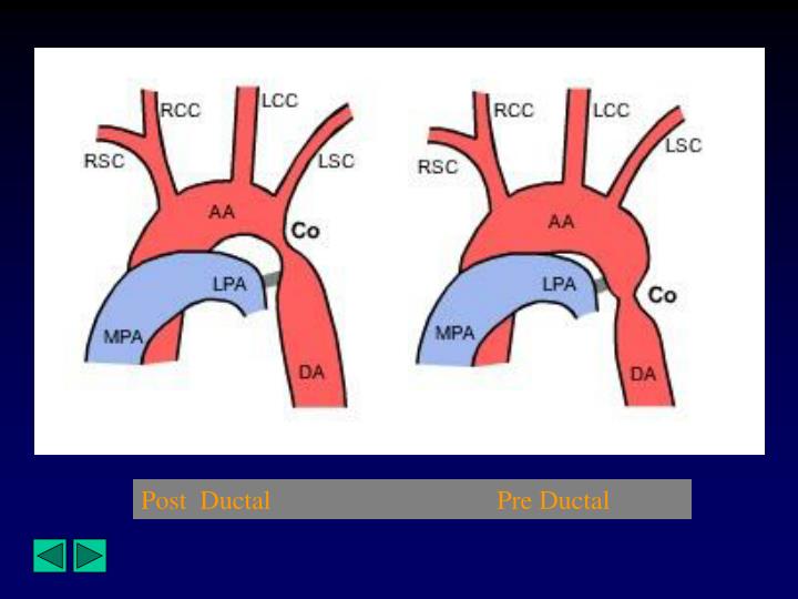 PPT - Findings: Rib Notching PowerPoint Presentation - ID:4936561