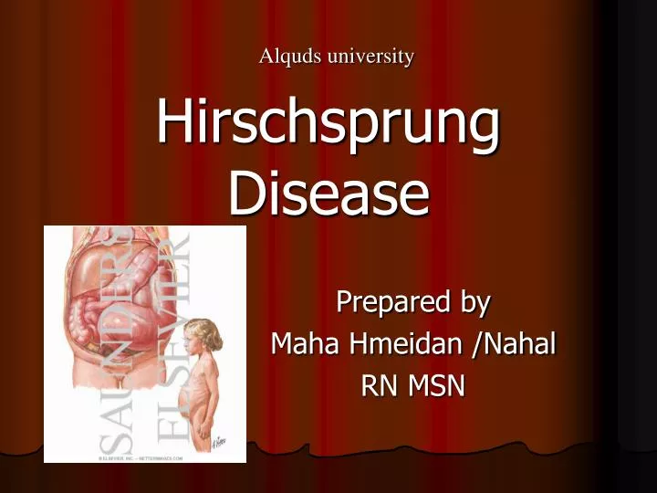 Ppt Hirschsprung Disease Powerpoint Presentation Id 4939141