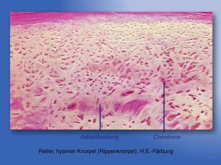 PPT - Krebs Was ist das? PowerPoint Presentation - ID:4953102