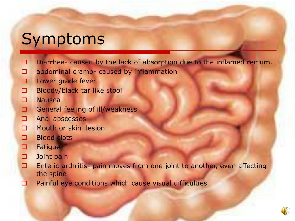 PPT - Crohn’s Disease PowerPoint Presentation, free download - ID:4954621 PPT - Crohn’s Disease PowerPoint Presentation, free download - ID:4954621