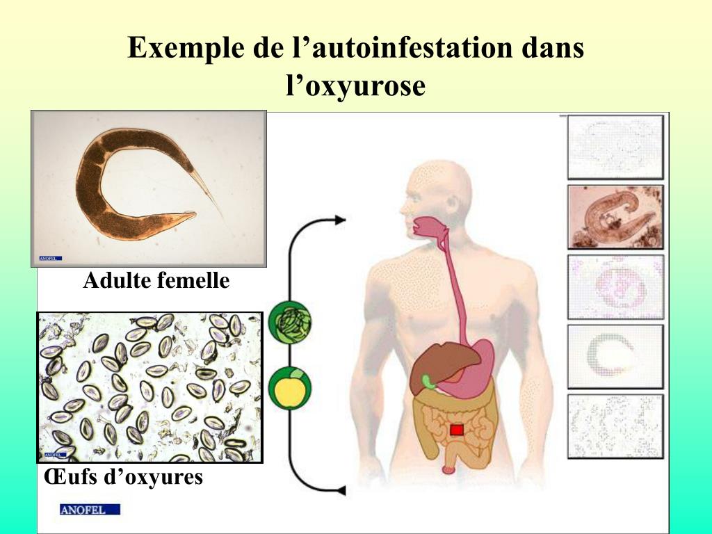 PPT - Larve de Trichine dans la cellule musculaire PowerPoint ...