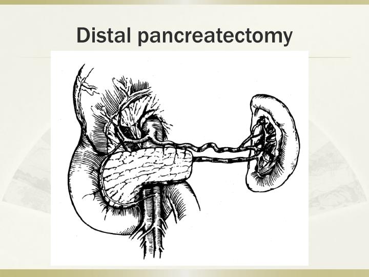 PPT - Traumatic Pancreatic Injury in paediatric patients PowerPoint ...