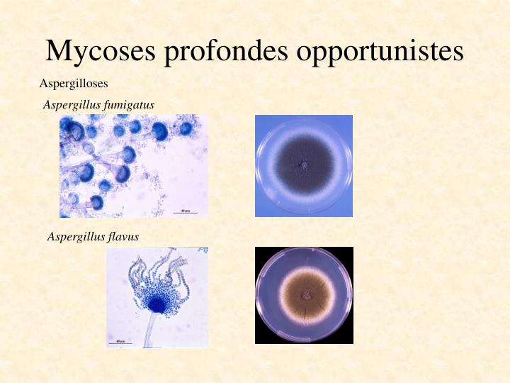 PPT - Les mycoses PowerPoint Presentation - ID:4963327