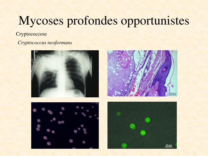 PPT - Les mycoses PowerPoint Presentation - ID:4963327
