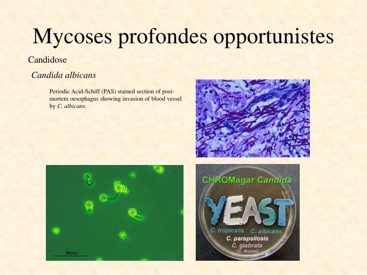 PPT - Les mycoses PowerPoint Presentation - ID:4963327