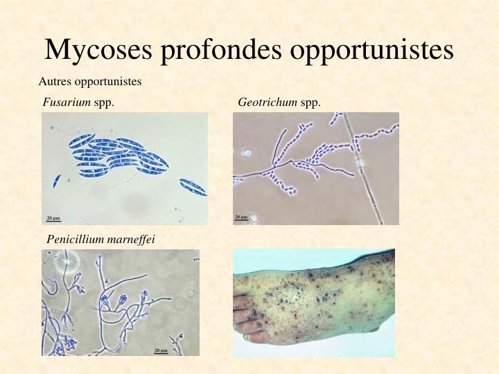 PPT - Les mycoses PowerPoint Presentation - ID:4963327
