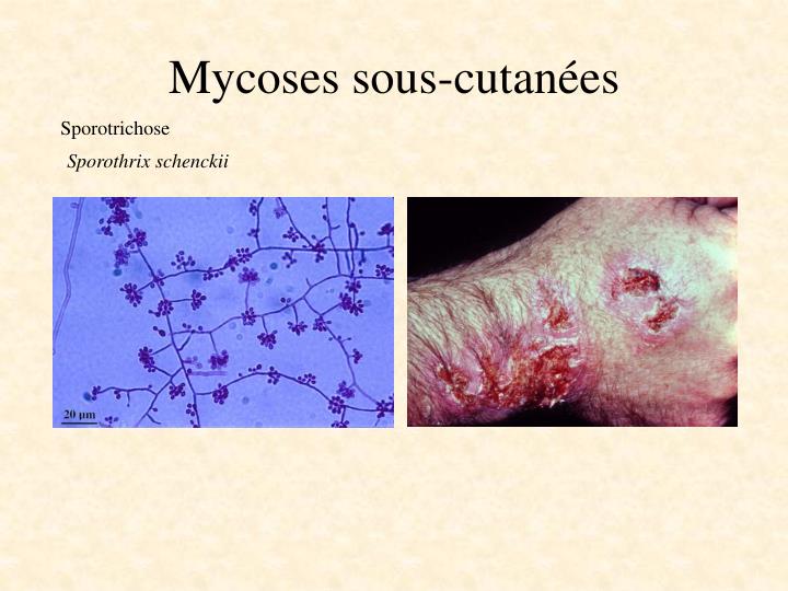 PPT - Les mycoses PowerPoint Presentation - ID:4963327