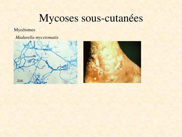 PPT - Les mycoses PowerPoint Presentation - ID:4963327