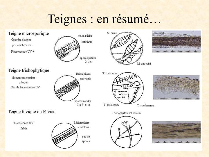 PPT - Les mycoses PowerPoint Presentation - ID:4963327