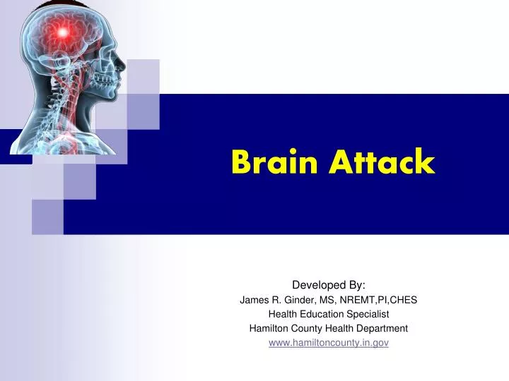 PPT - Brain Attack PowerPoint Presentation, free download - ID:4967172