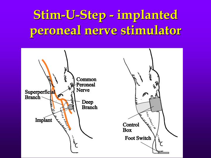 PPT - Functional Electrical Stimulation (FES) - a re-emerging ...